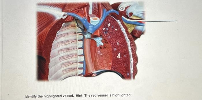 Solved Identify the highlighted vessel. Hint: The red vessel | Chegg.com