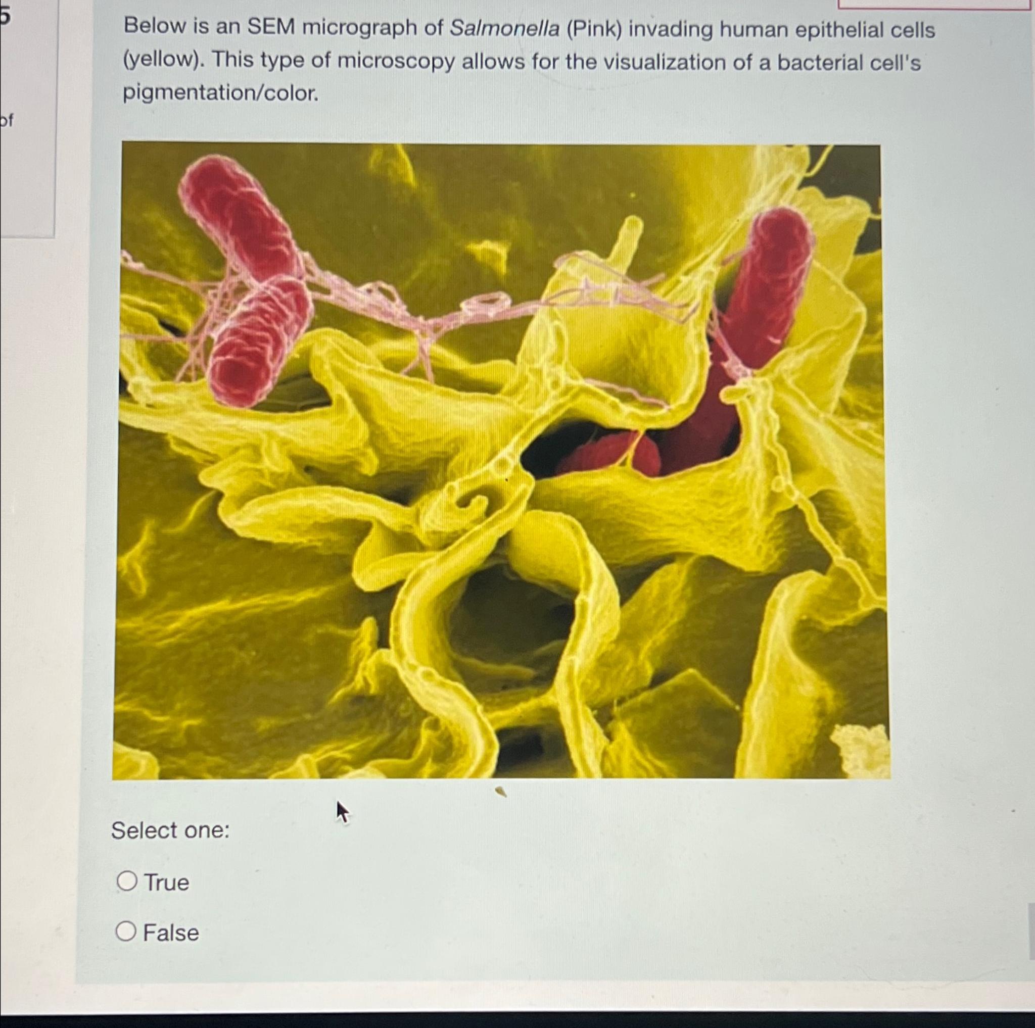 Solved Below is an SEM micrograph of Salmonella (Pink) | Chegg.com