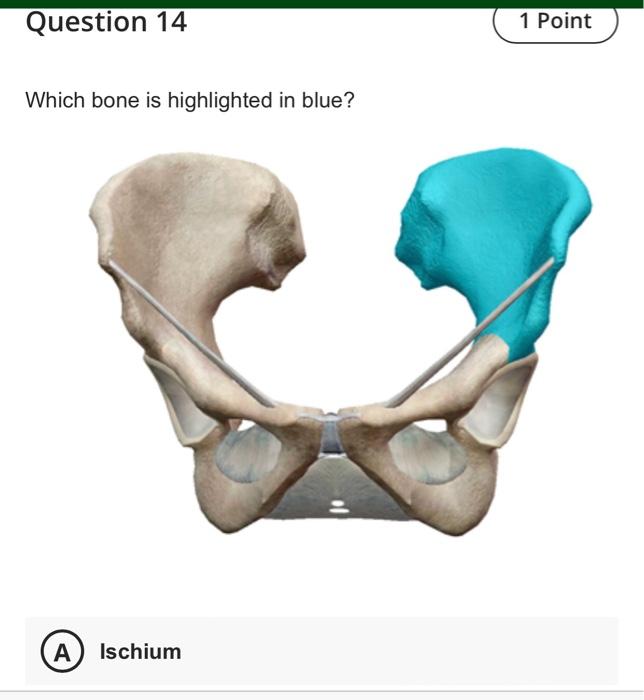 Solved Which bone is highlighted in blue? (A) | Chegg.com