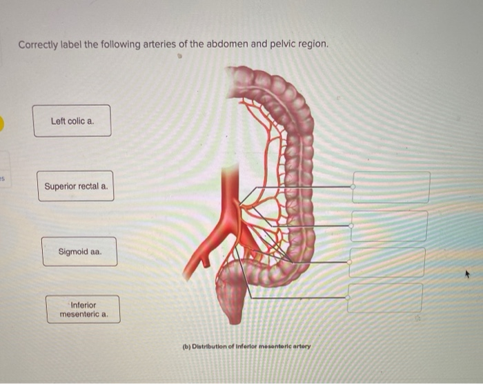 Solved Correctly label the following arteries of the abdomen | Chegg.com