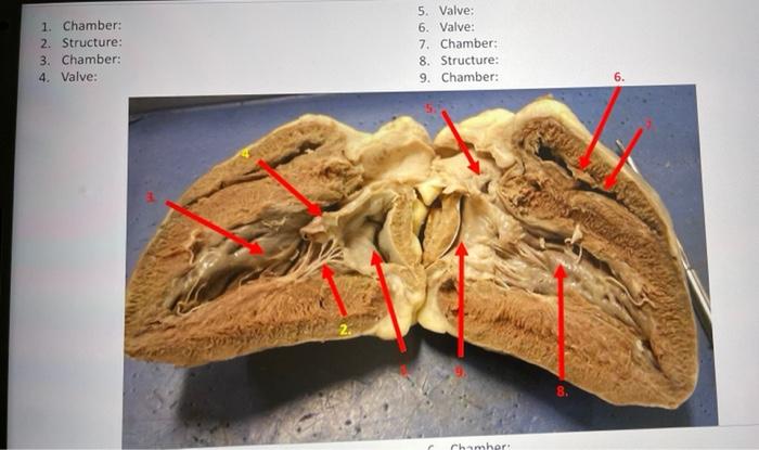 Solved 1. Chamber: 2. Structure: 3. Chamber: 4. Valve: 5. | Chegg.com