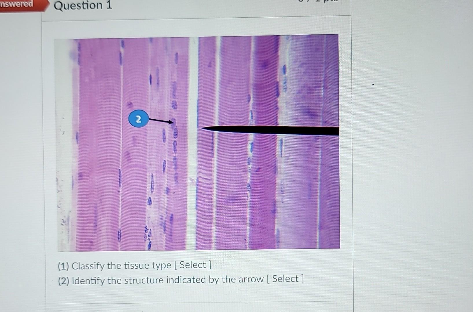 Solved (9) Classify the tissue type [ Select ] (10) Identify | Chegg.com