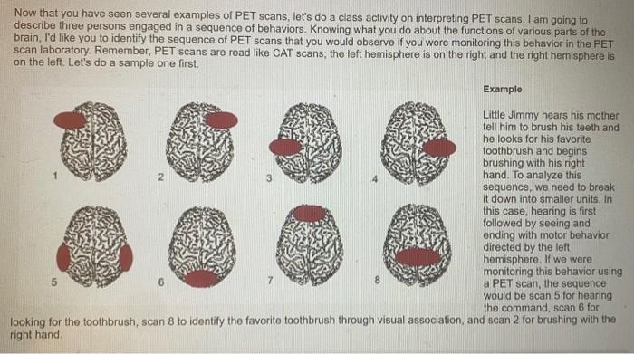 Solved Now that you have seen several examples of PET scans, | Chegg.com