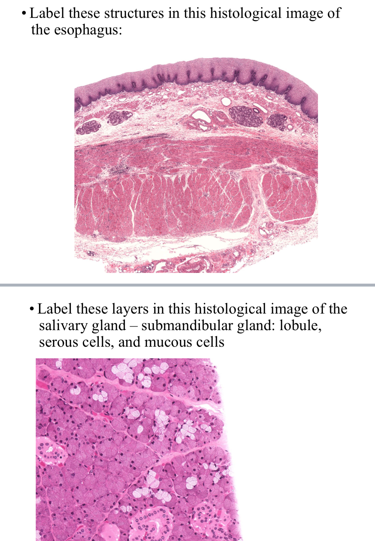 Solved Label these structures in this histological image of | Chegg.com