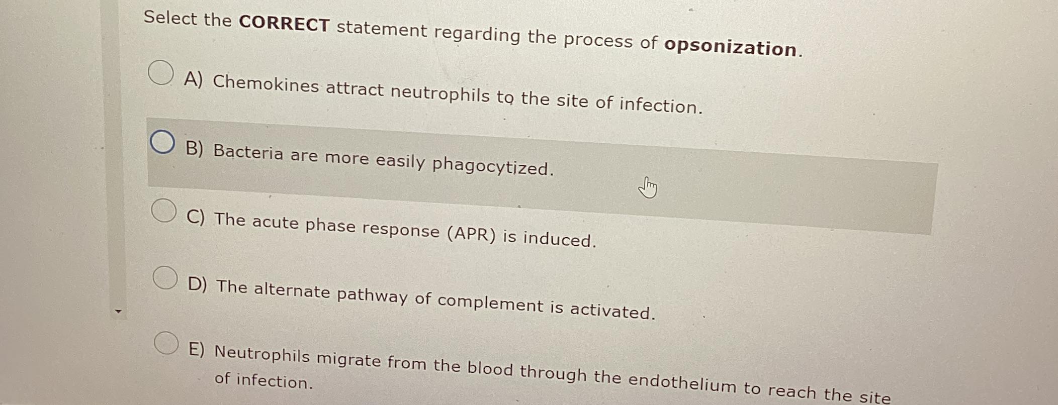 Solved Select the CORRECT statement regarding the process of | Chegg.com