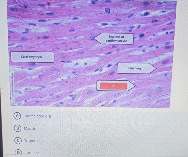 Solved ﻿Intercalated diskMyosinTroponin ﻿Cartilage | Chegg.com