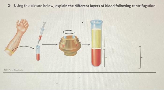 Solved 2- Explain what is shown in the picture below: (c) Y | Chegg.com