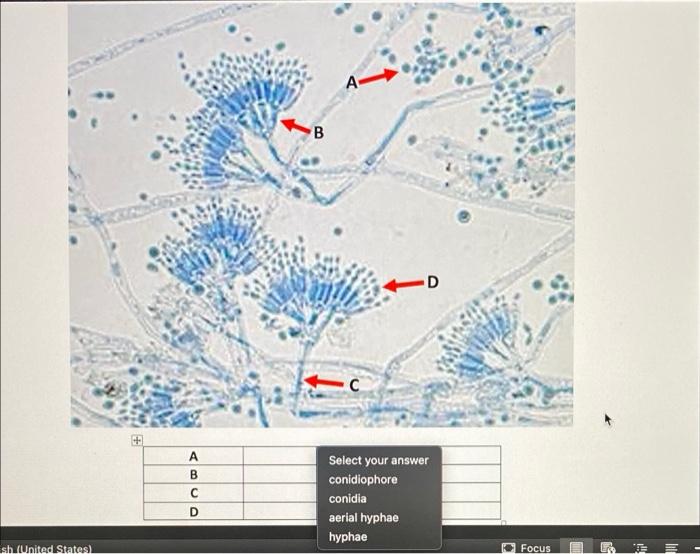 Solved IDENTIFICATION OF MOLD STRUCTURES Module 5 Lab | Chegg.com