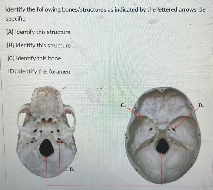Identify the following bones/structures as indicated | Chegg.com