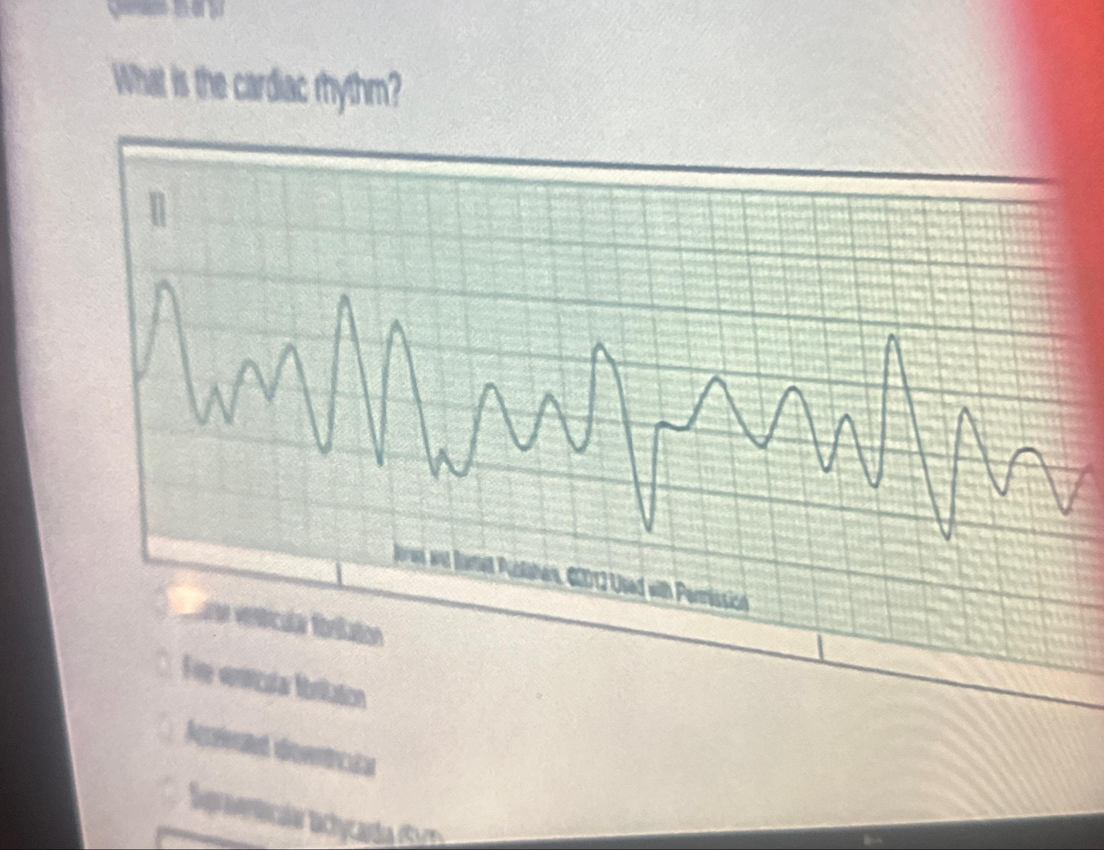 What is the cardiac rhythm ﻿Course ventricular | Chegg.com
