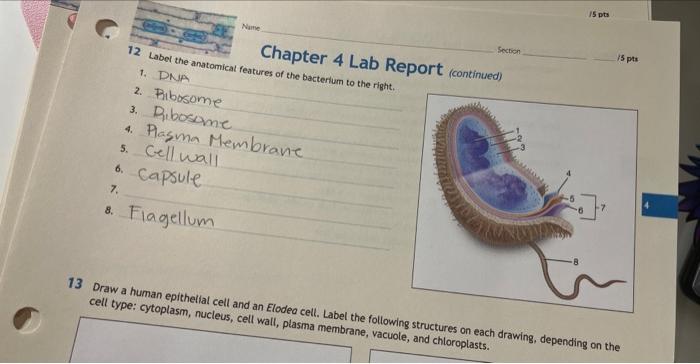 13 Draw a human epithelial cell and an Elodeo cell. | Chegg.com