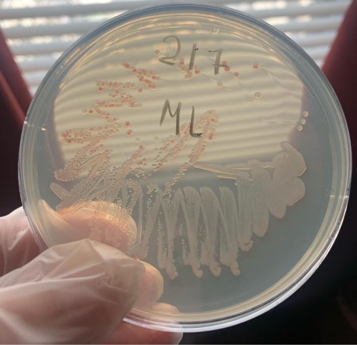 Solved 1) Did you obtain isolated colonies? If so, explain | Chegg.com