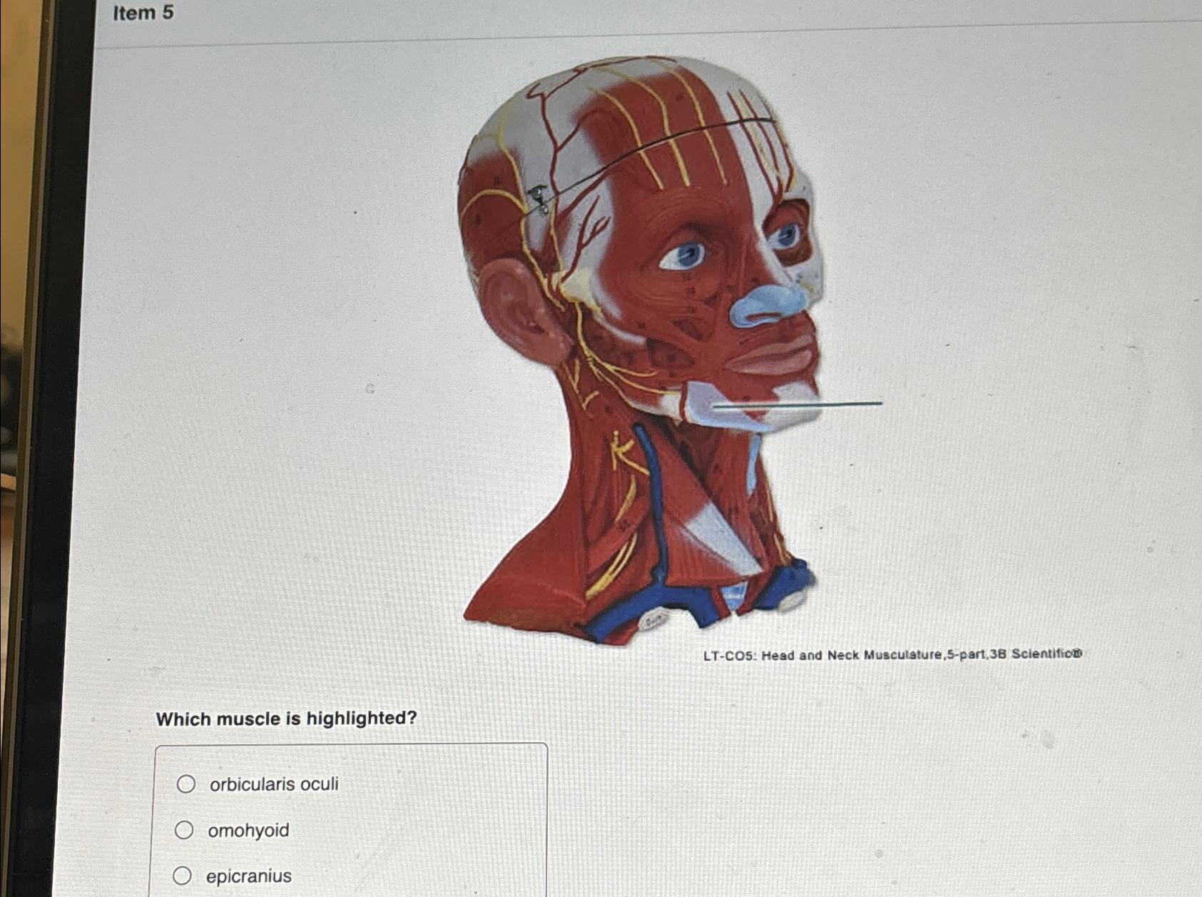 Solved Item 5LT-CO5: Head and Neck Musculature,5-part,3B | Chegg.com
