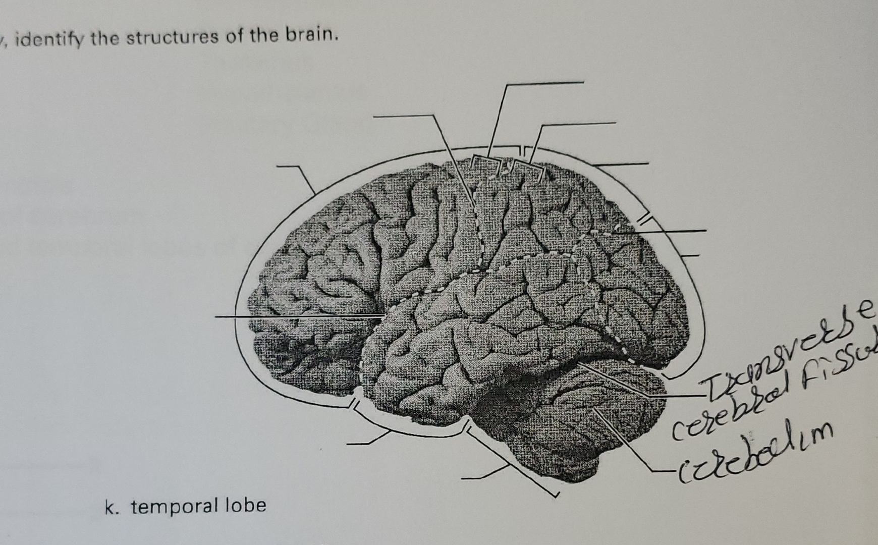 Solved identify the structures of the brain.k. ﻿temporal | Chegg.com
