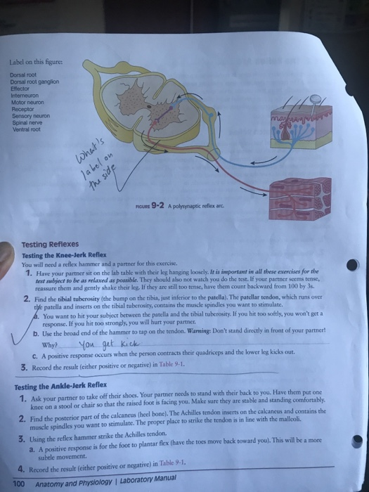 Solved Label on this figures Dorsal root Dorsal root | Chegg.com