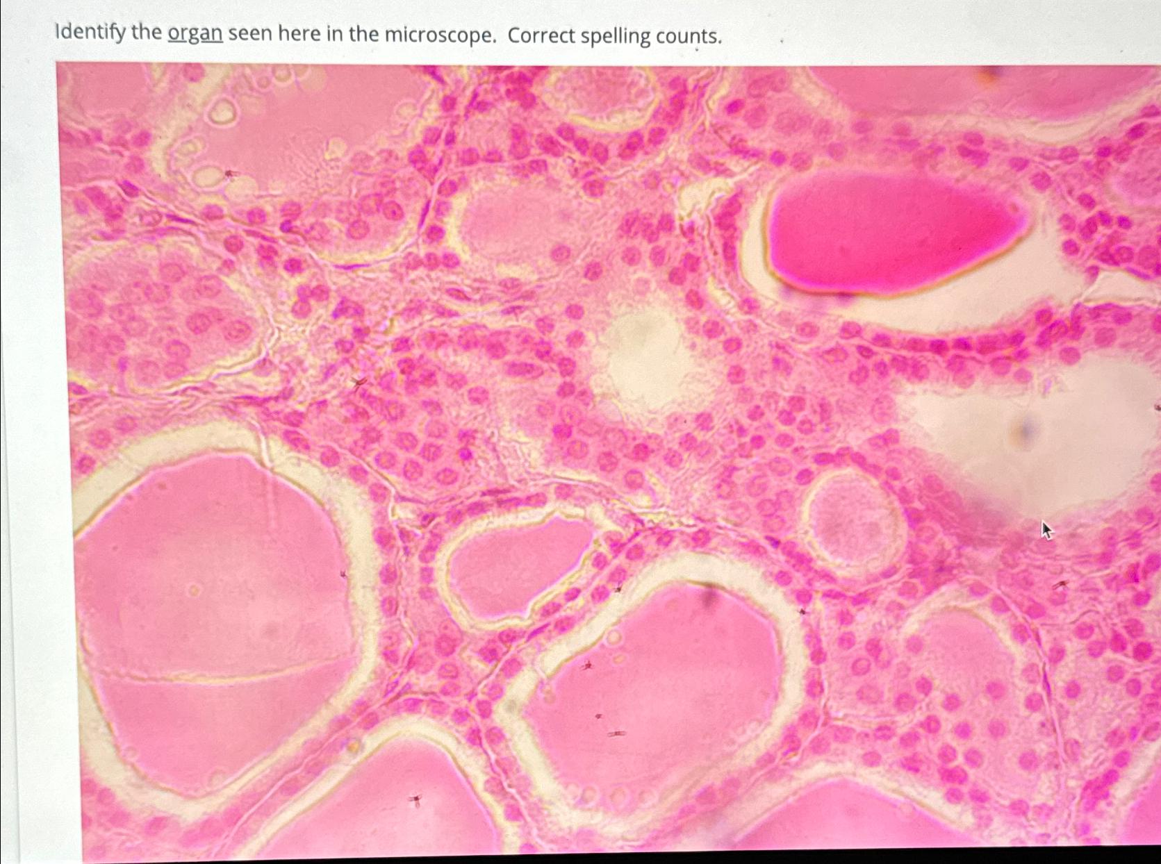 Solved Identify the organ seen here in the microscope. | Chegg.com