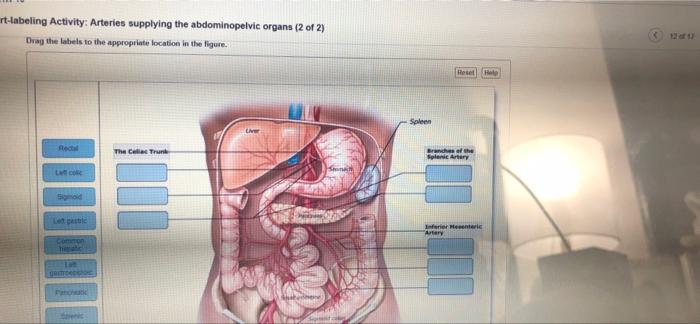 Solved rt-labeling Activity: Arteries supplying the | Chegg.com