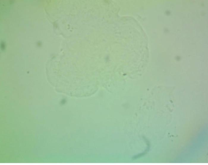 Solved this image was taken from human cheek cell slide x100 | Chegg.com