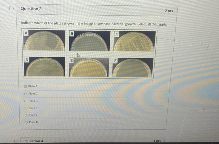 Solved Indicate which of the plates shown in the image below | Chegg.com