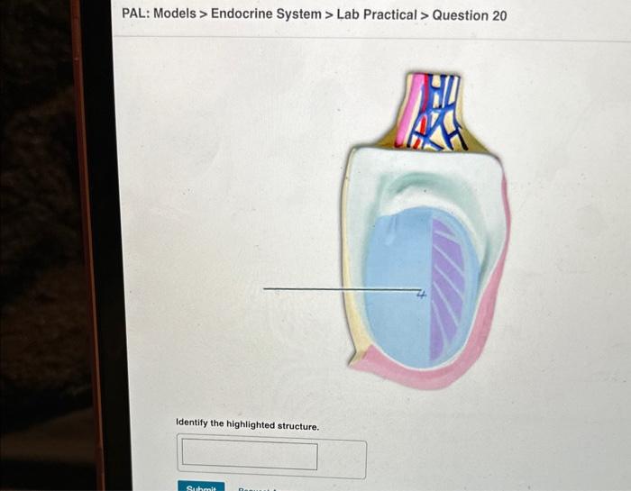 Solved PAL: Models > Endocrine System > Lab Practical > | Chegg.com