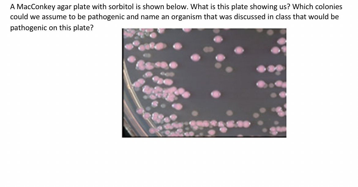 Solved A MacConkey agar plate with sorbitol is shown below. | Chegg.com