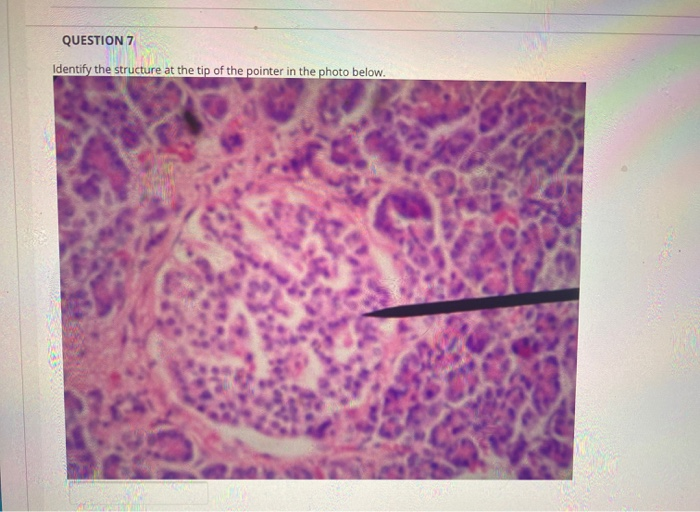 Solved Identify the structure at the tip of the pointer in | Chegg.com