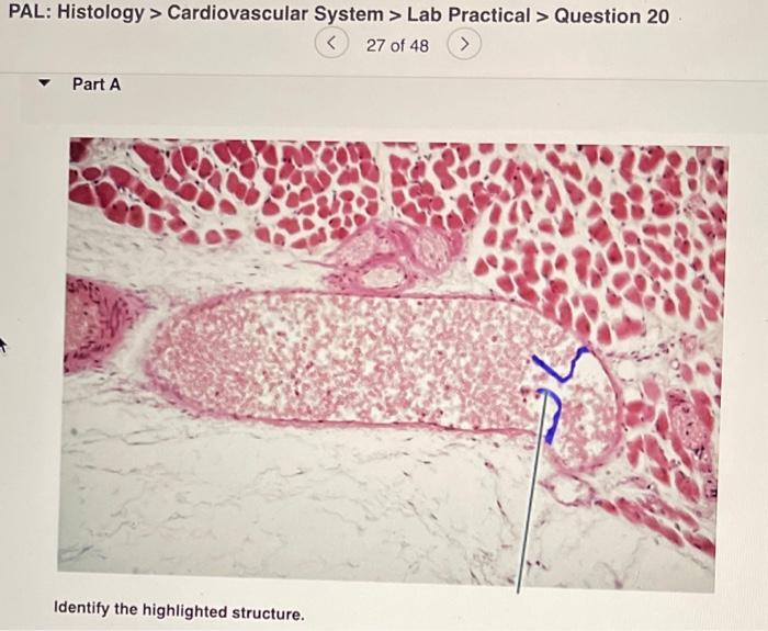 Solved PAL: Histology > Cardiovascular System > Lab | Chegg.com