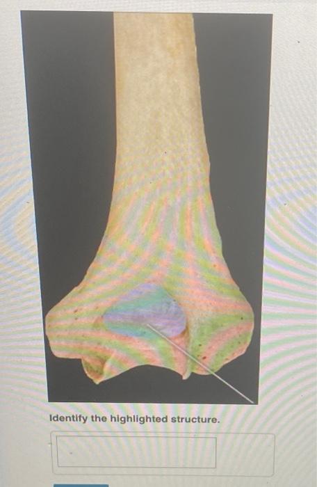 Solved Identify the highlighted structure. | Chegg.com