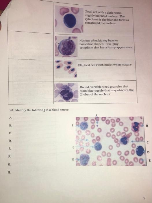Solved Small cell with a dark round slightly indented | Chegg.com