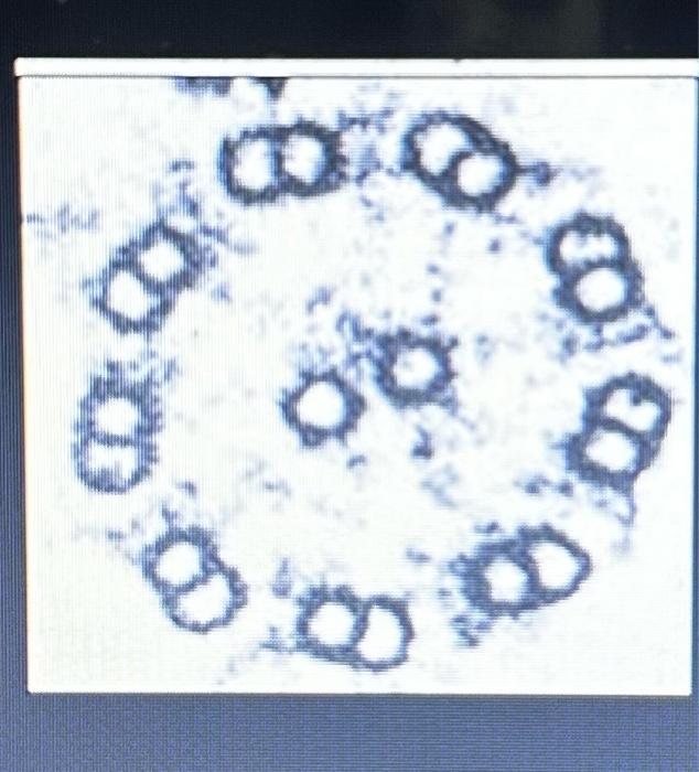 Solved The following structure, formed by microtubules, is | Chegg.com