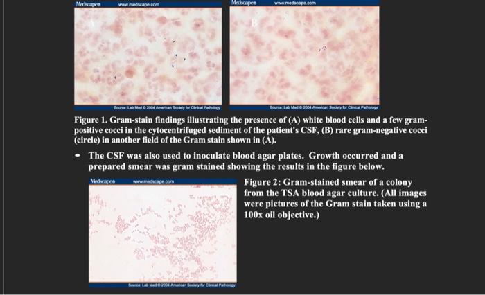 Solved igure 1. Gram-stain findings illustrating the | Chegg.com