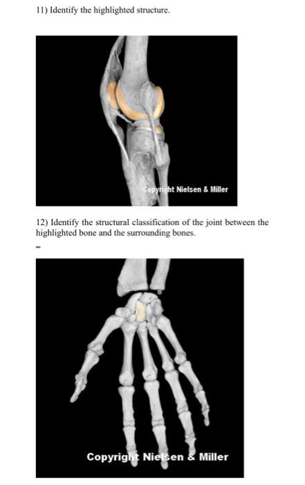 Solved 11) Identify the highlighted structure. Copyright | Chegg.com