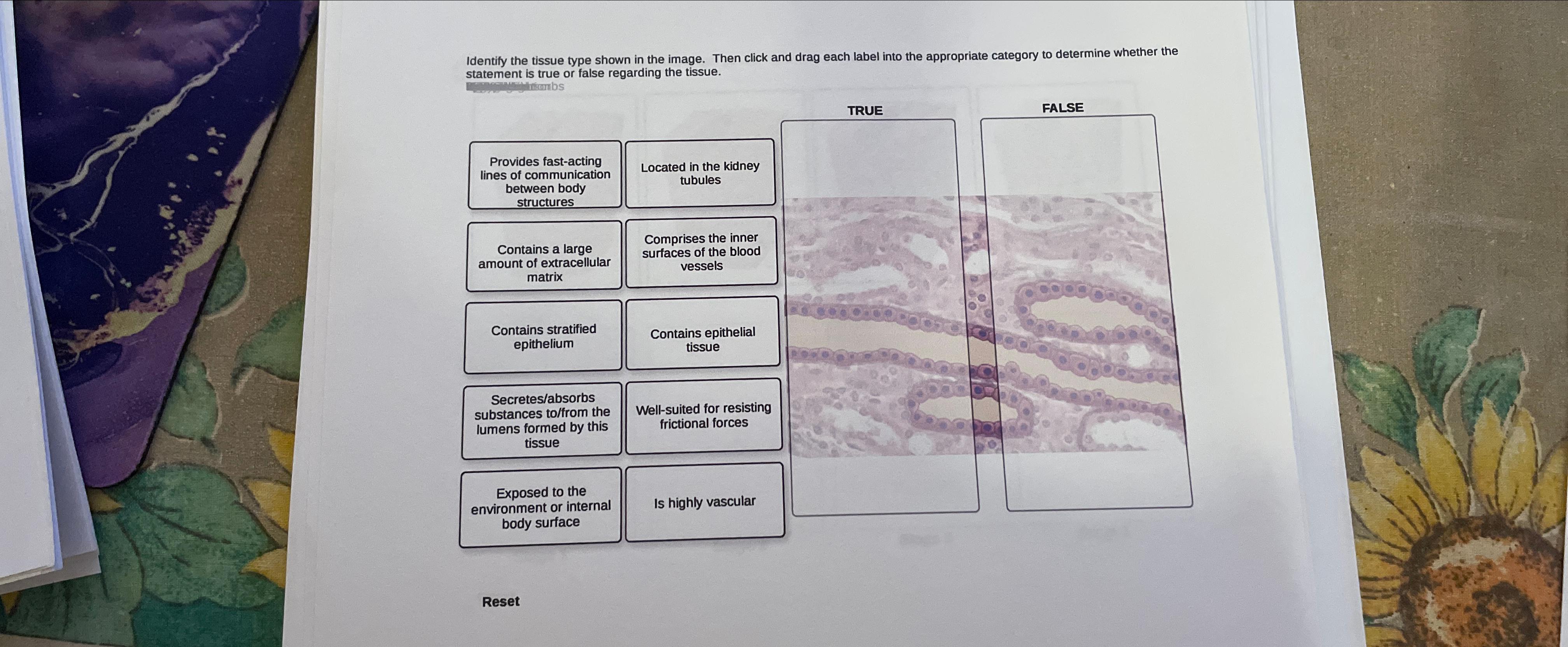 Solved Identify the tissue type shown in the image. Then | Chegg.com