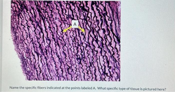 Solved Name the specific fibers indicated at the points | Chegg.com