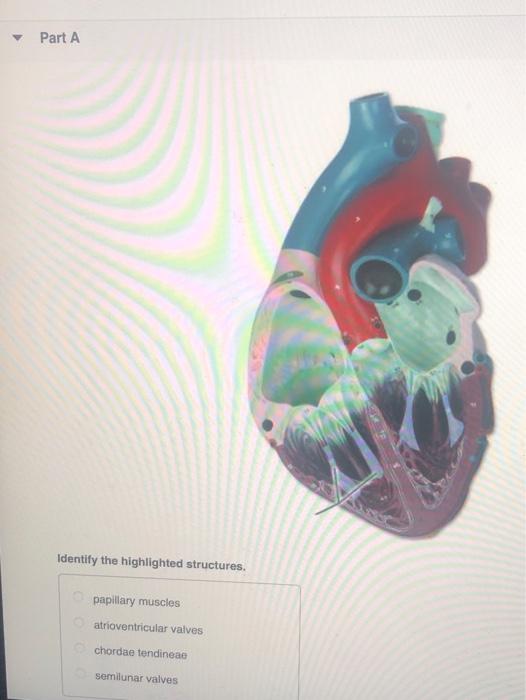Solved Part A Identify the highlighted structures. papillary | Chegg.com