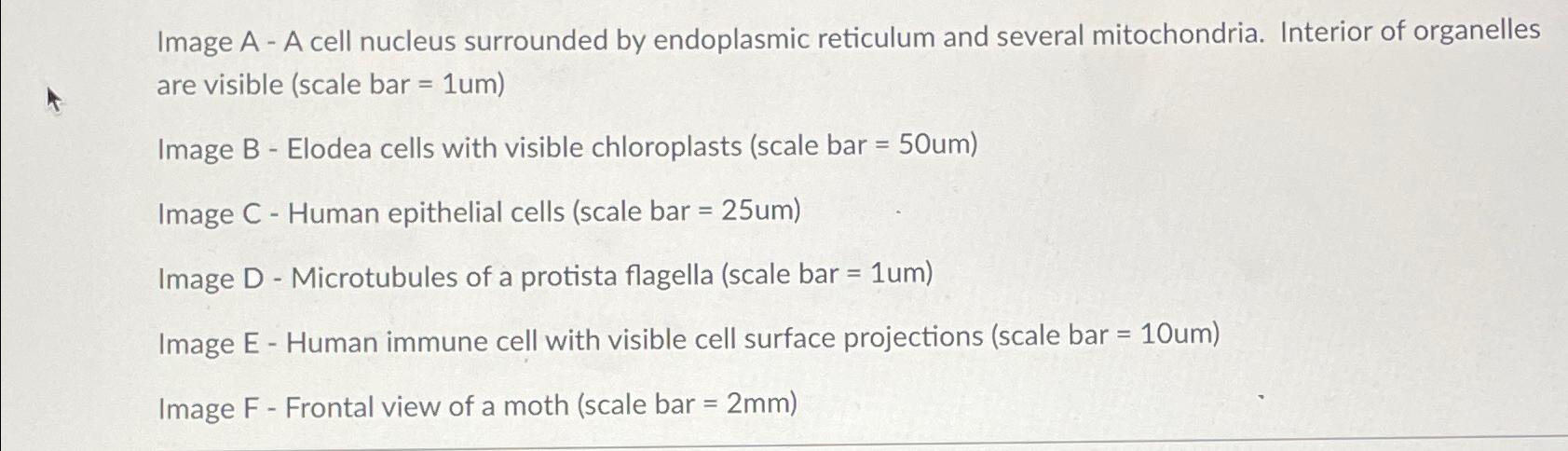 Solved Image A - ﻿A cell nucleus surrounded by endoplasmic | Chegg.com