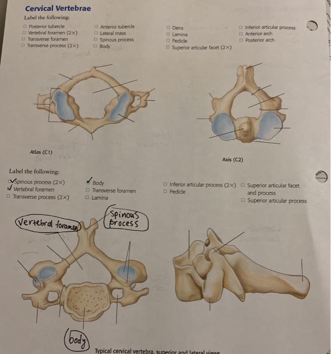 Cervical Vertebrae Labeled Axis