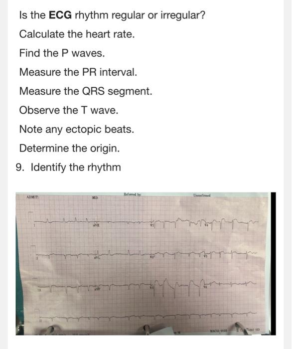Solved Is the ECG rhythm regular or irregular? Calculate the | Chegg.com