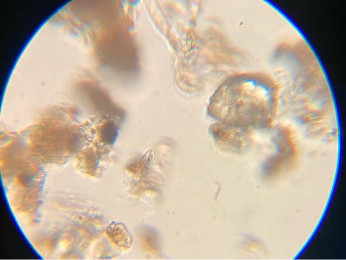 Solved Each of these samples were drawn from lakes and | Chegg.com