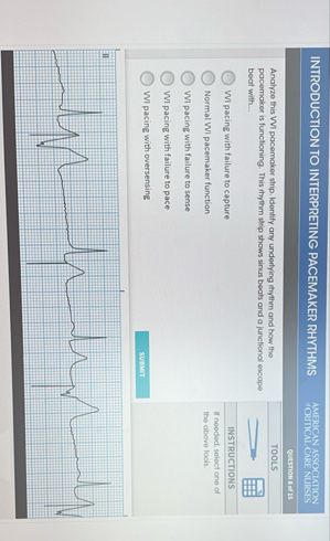 Solved INTRODUCTION TO INTERPRETING PACEMAKER | Chegg.com