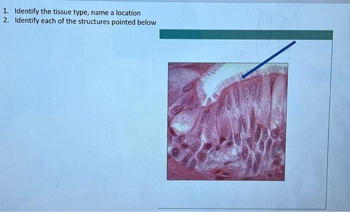 Solved Identify the name of each of the following tissue | Chegg.com