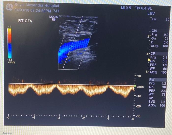 Solved The image and spectral tracing below are | Chegg.com