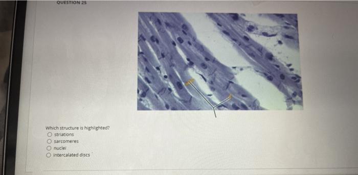 Solved QUESTION 25 Which structure is highlighted? | Chegg.com