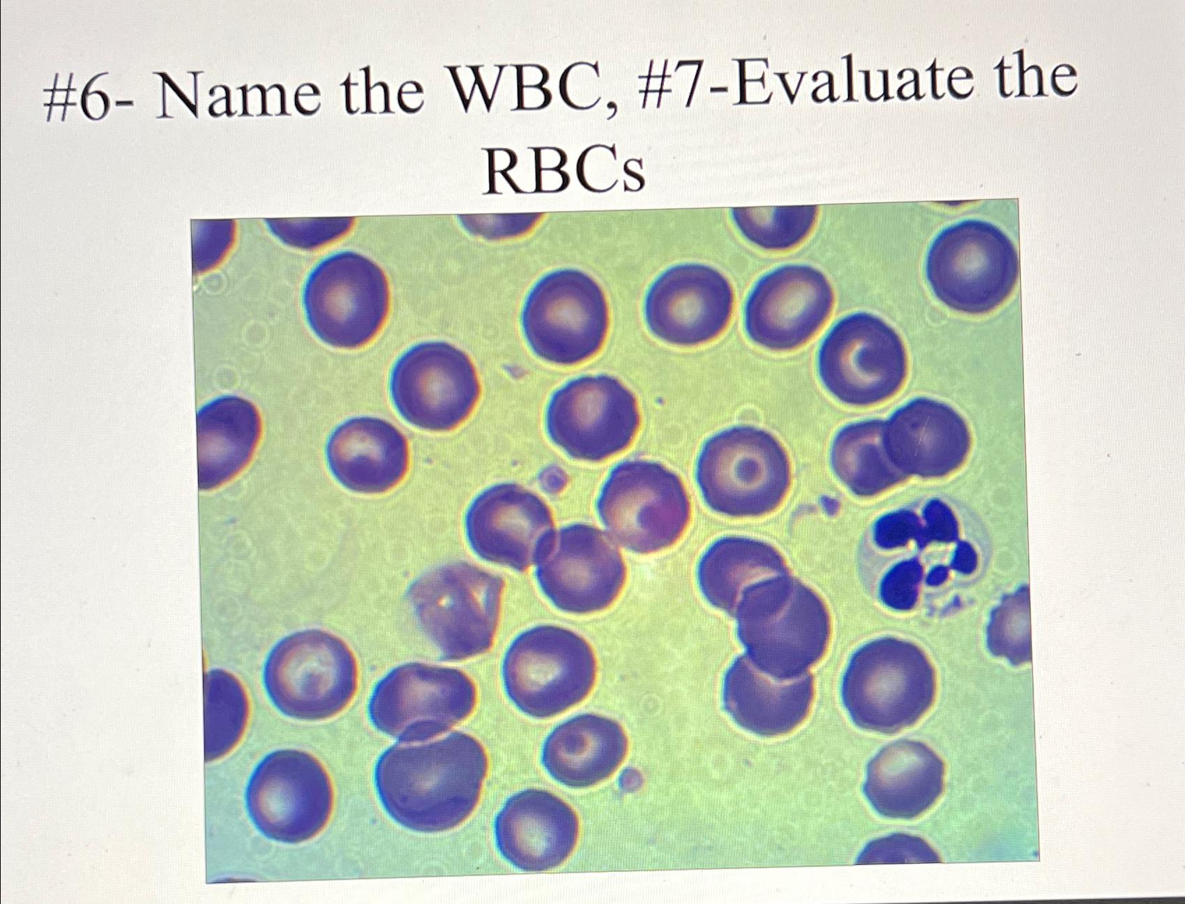 Solved #6- ﻿Name the WBC, ﻿#7-Evaluate the RBCs | Chegg.com