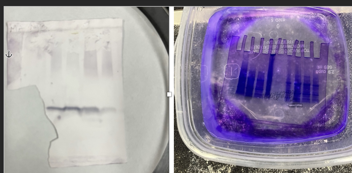 Solved Using the picture of imperial stained gel and western | Chegg.com