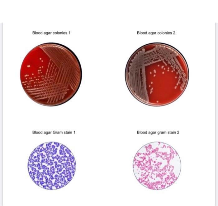 Solved Blood agar colonies 1 Blood agar colonies 2 Blood | Chegg.com