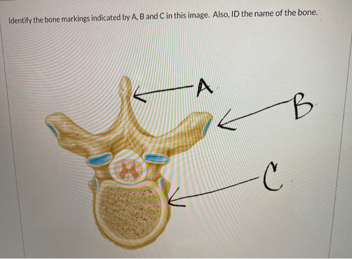 Solved Identify the bone markings indicated by A, B and C in | Chegg.com