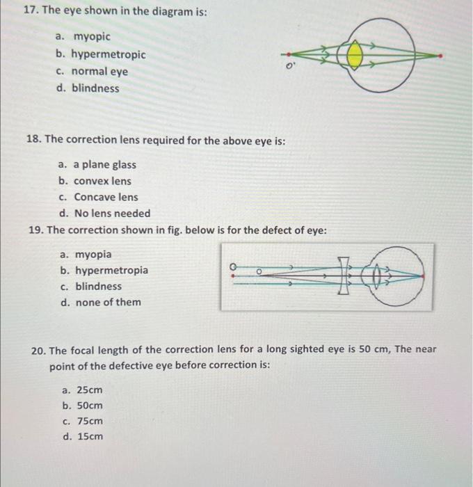 Solved 17. The eye shown in the diagram is: a. myopic b. | Chegg.com