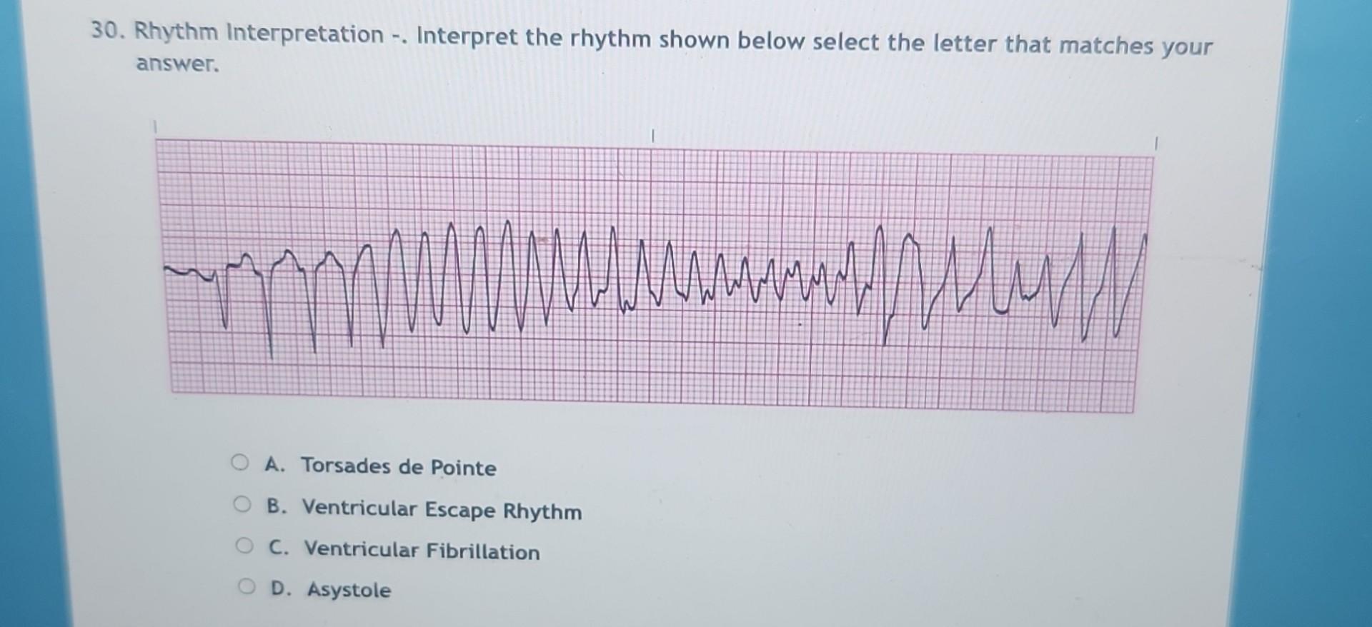 Solved 30. Rhythm Interpretation -. Interpret the rhythm | Chegg.com