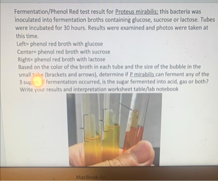 MRVP and Citrate LABS WORKSHEET MRVP DATA Name of | Chegg.com